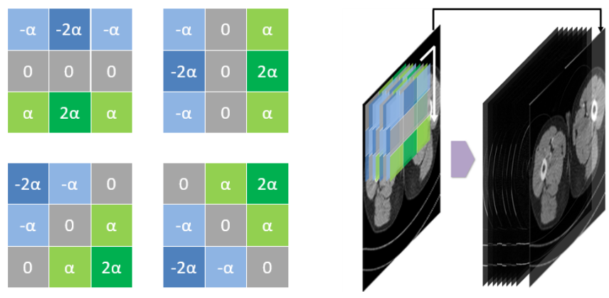 (2020)EDCNN: Edge enhancement-based Densely Connected Network with Compound Loss for Low-Dose CT ...